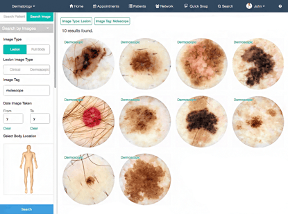DermEngine | The World's Most Advanced Skin Analytics System