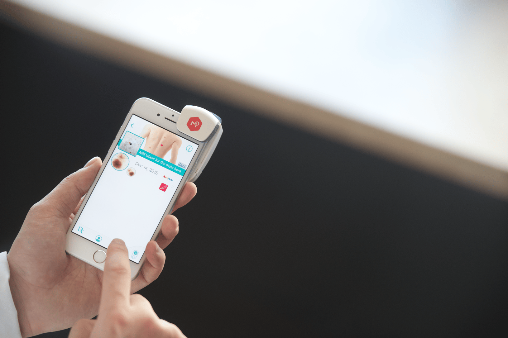 Mobile Dermoscopy For Effective Patient eTriage