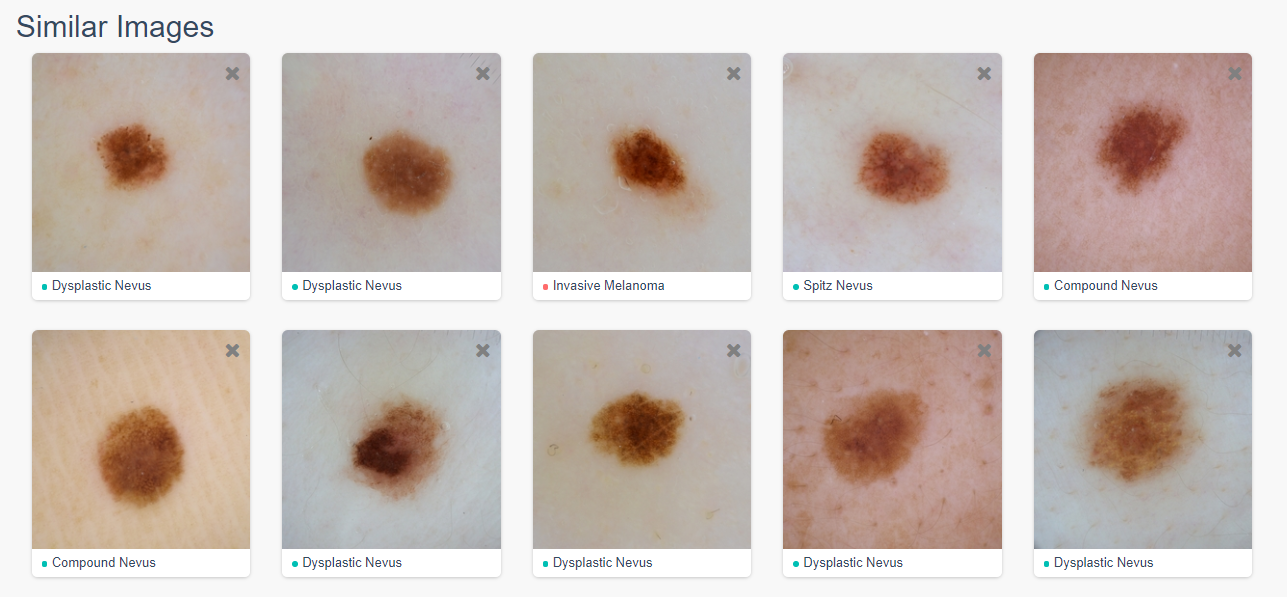 Visual Search: A Powerful, Intelligent Tool in Dermatology