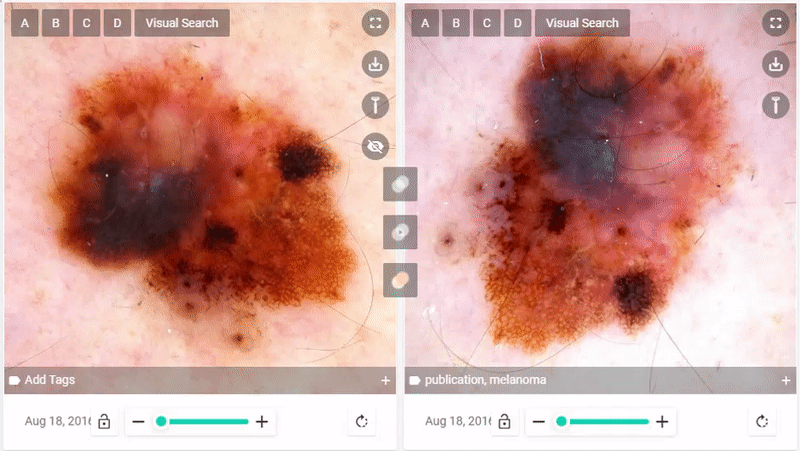 DermEngine | The Forefront of Intelligent Dermatology