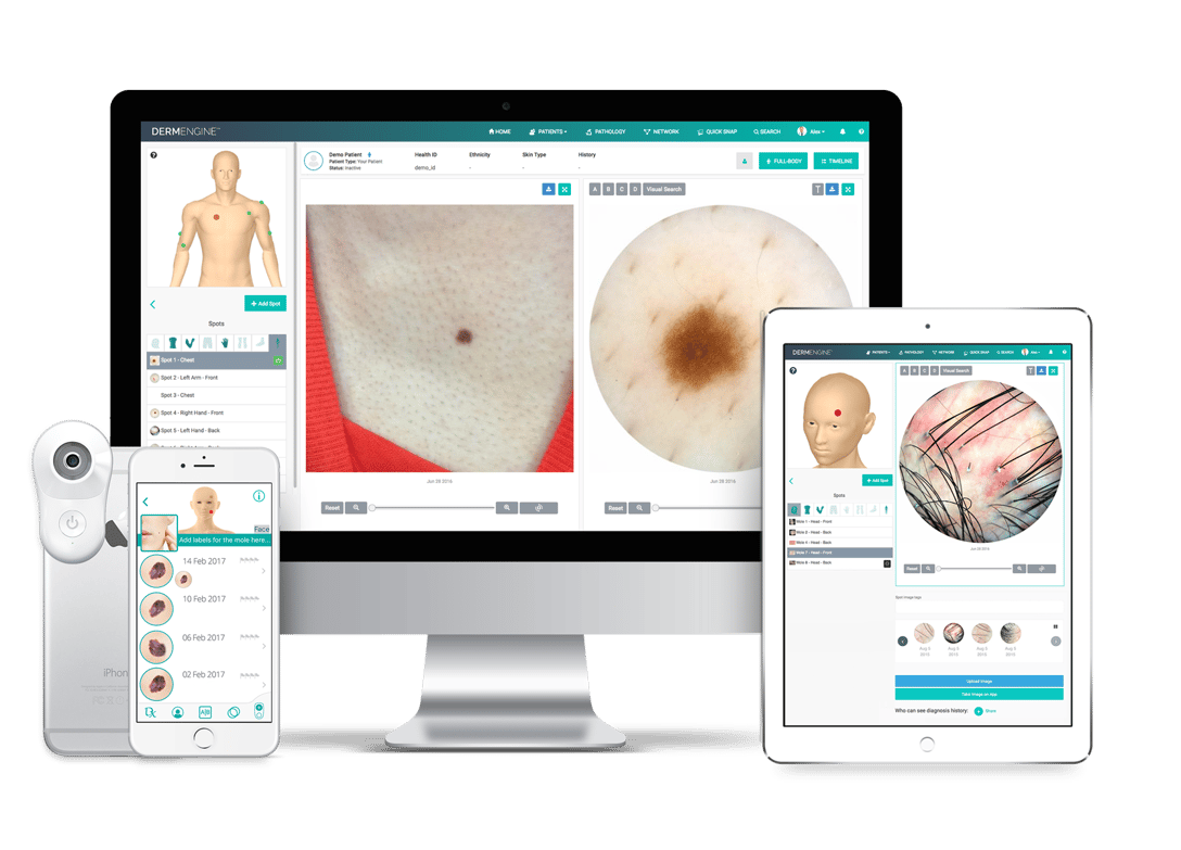 MetaOptima Technology raises $8.6 million CAD