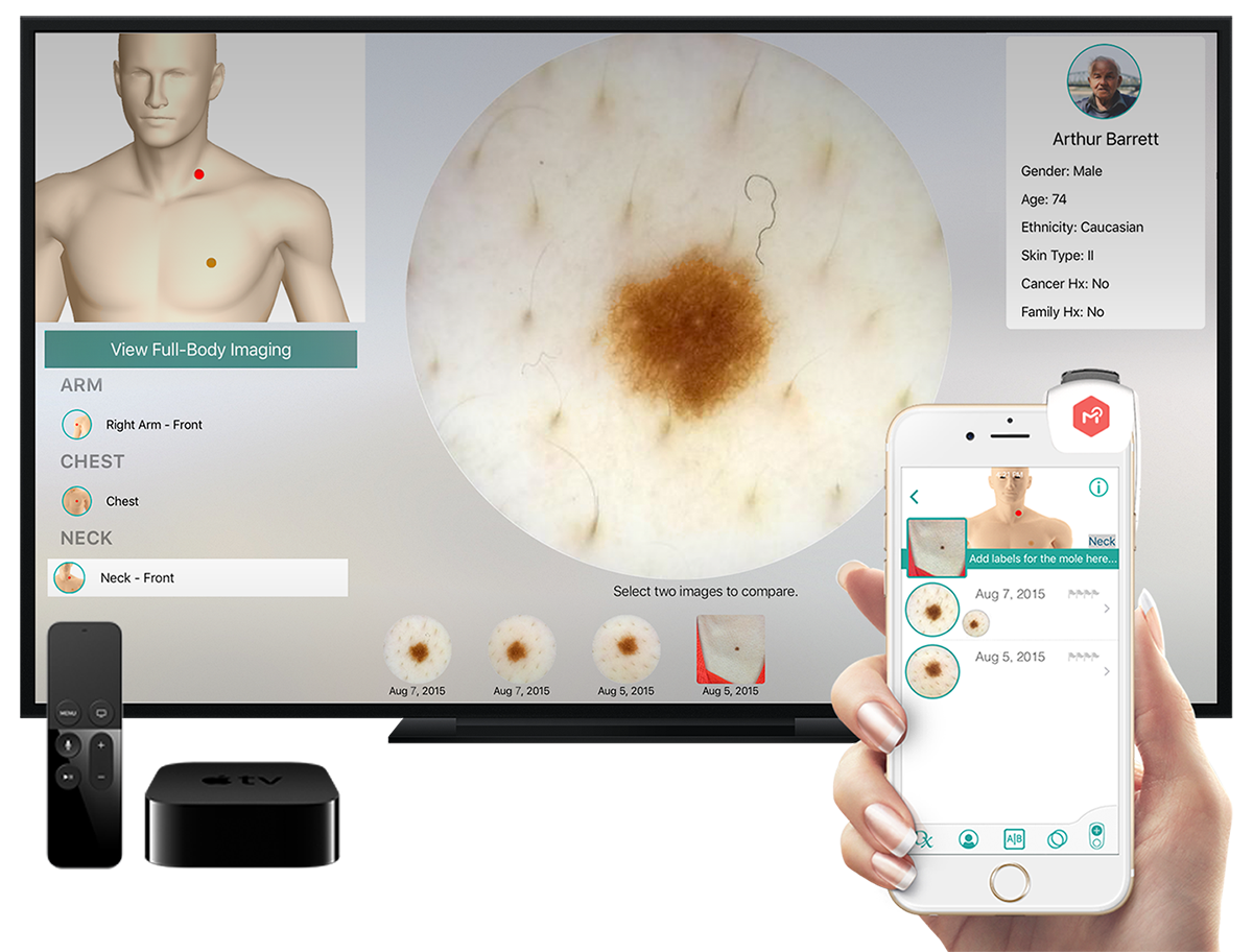 DermEngine | The Most Intelligent Dermatology Platform