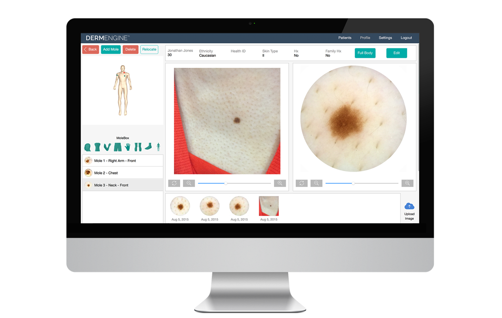 DermEngine | The World's Most Advanced Skin Analytics System