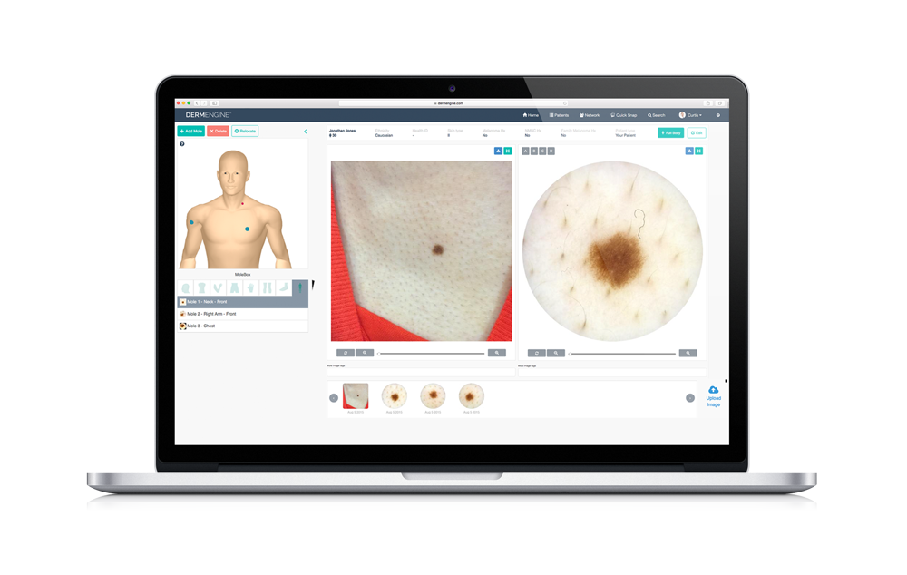 DermEngine | The World's Most Advanced Skin Analytics System