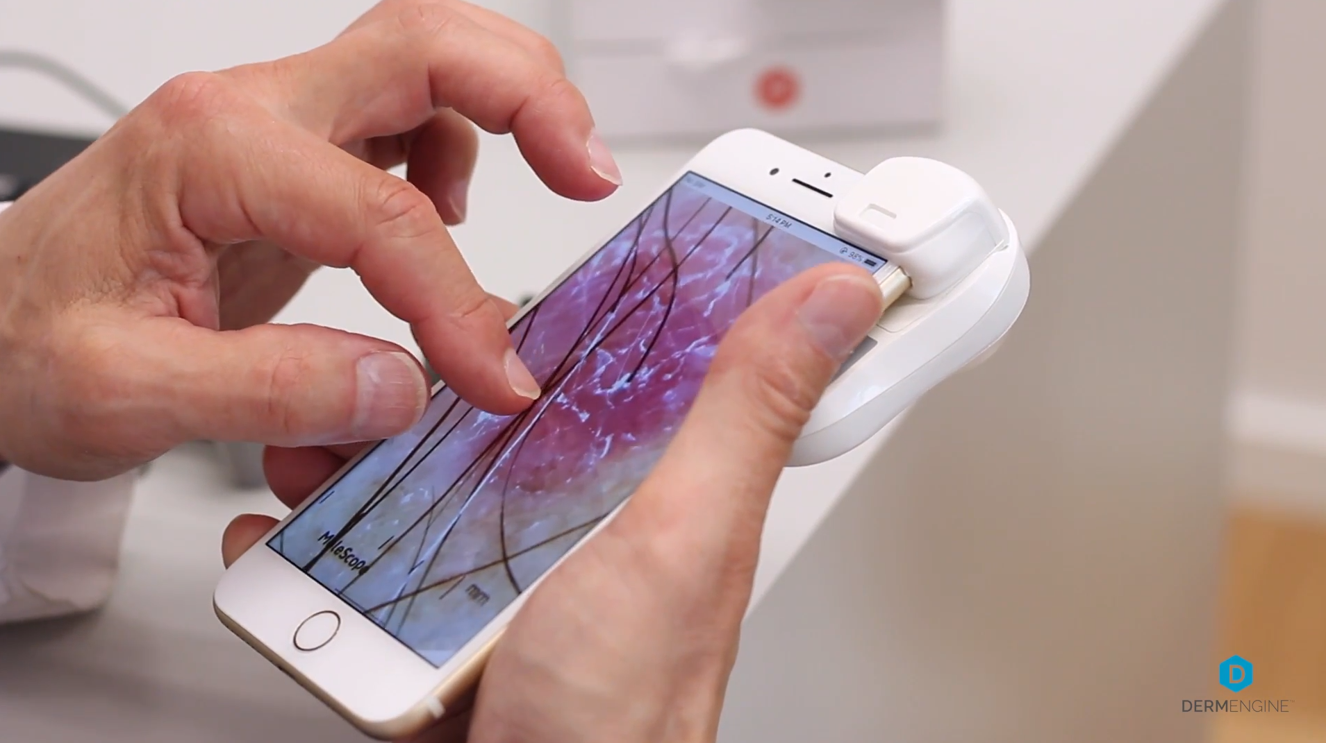 How Can Mobile Dermoscopy Support Practice Workflows?