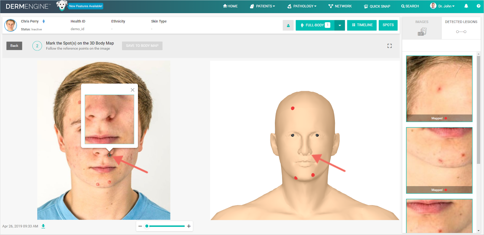 Enhanced Total Body Photography Module