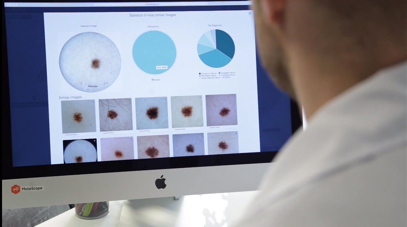 The Results Of Artificial Intelligence In Dermatology