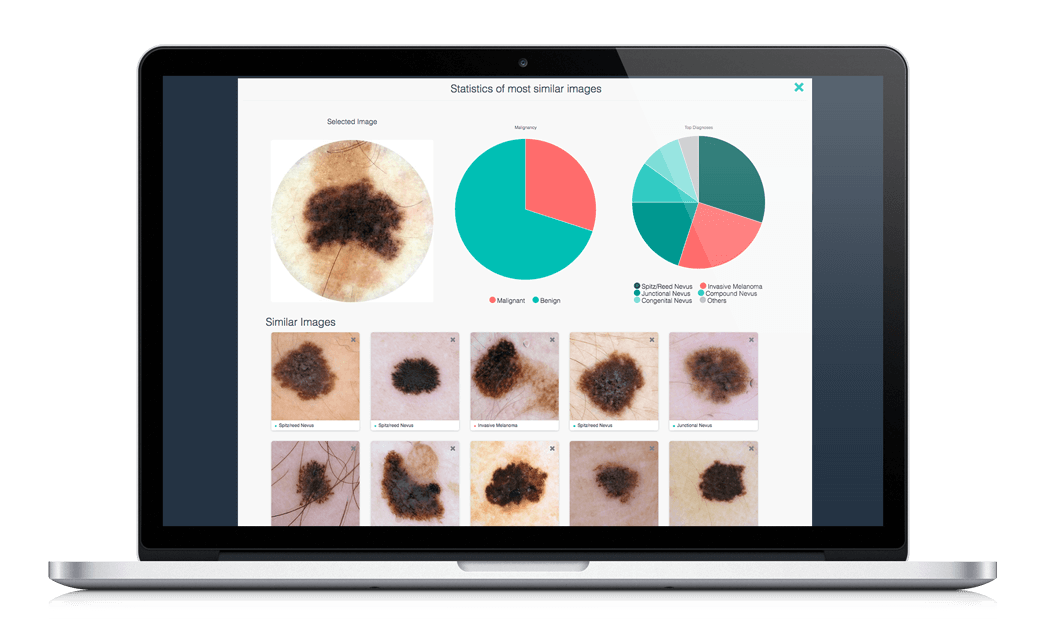DermEngine | Visual Search