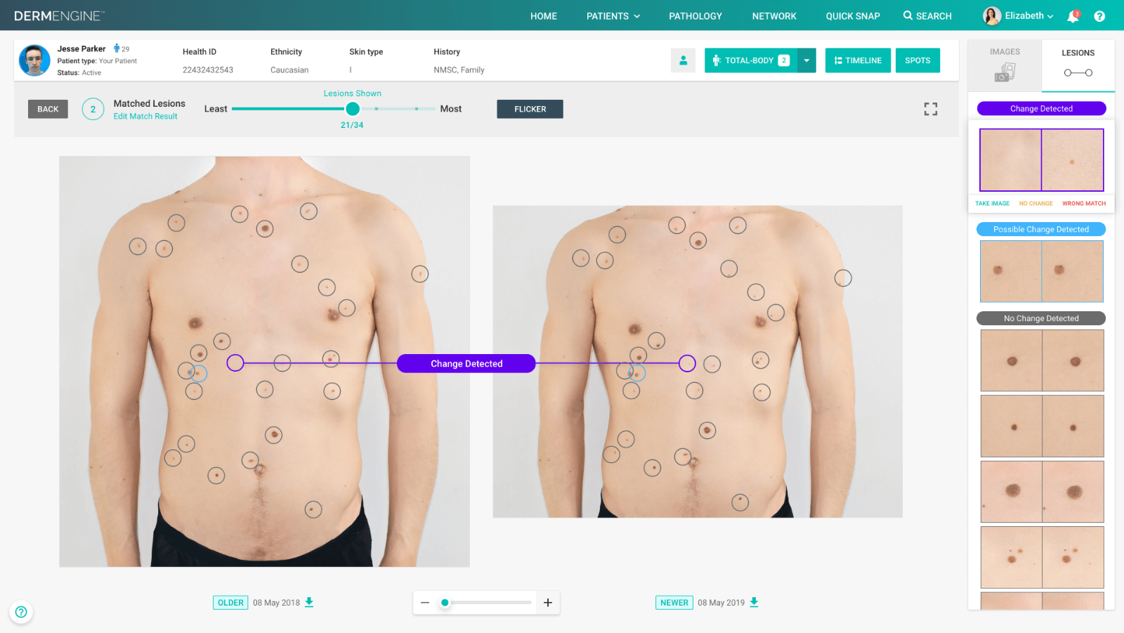 DermEngine | Total Body Photography