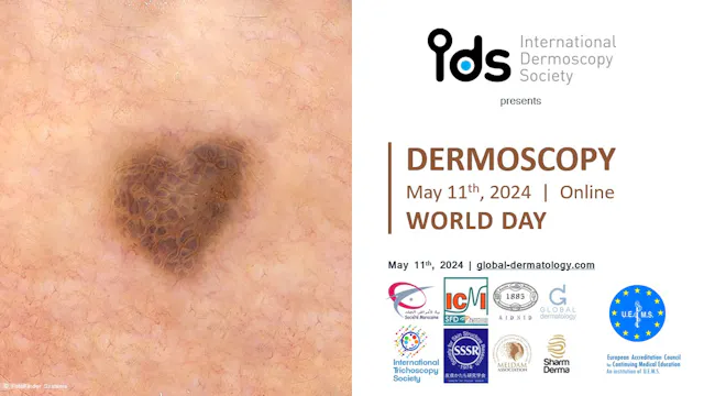 Invitation to the first 'Dermoscopy | World Day' online on Saturday ...