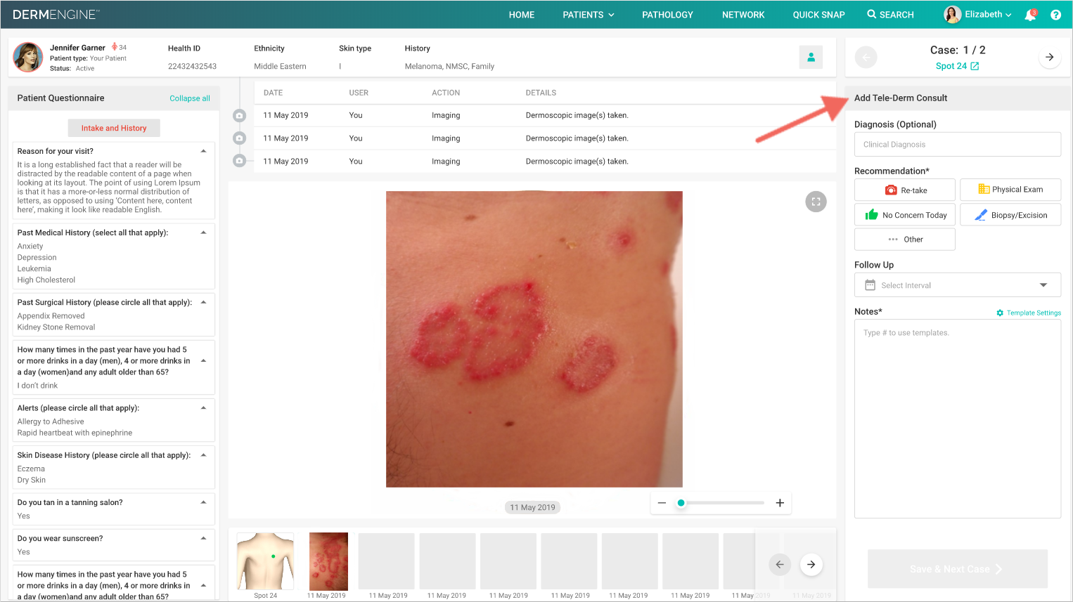 New Teledermatology Panel