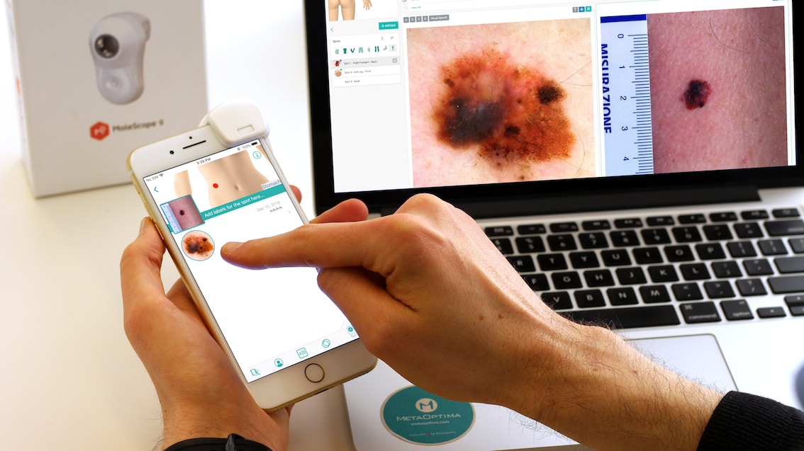 5 Facts About Teledermoscopy: Part 1