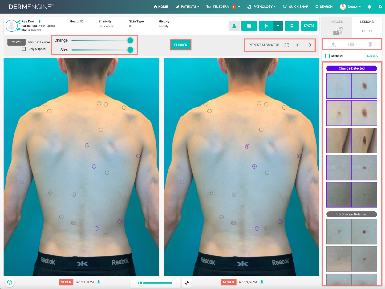New Navigation Buttons for a Streamlined TBP Workflow