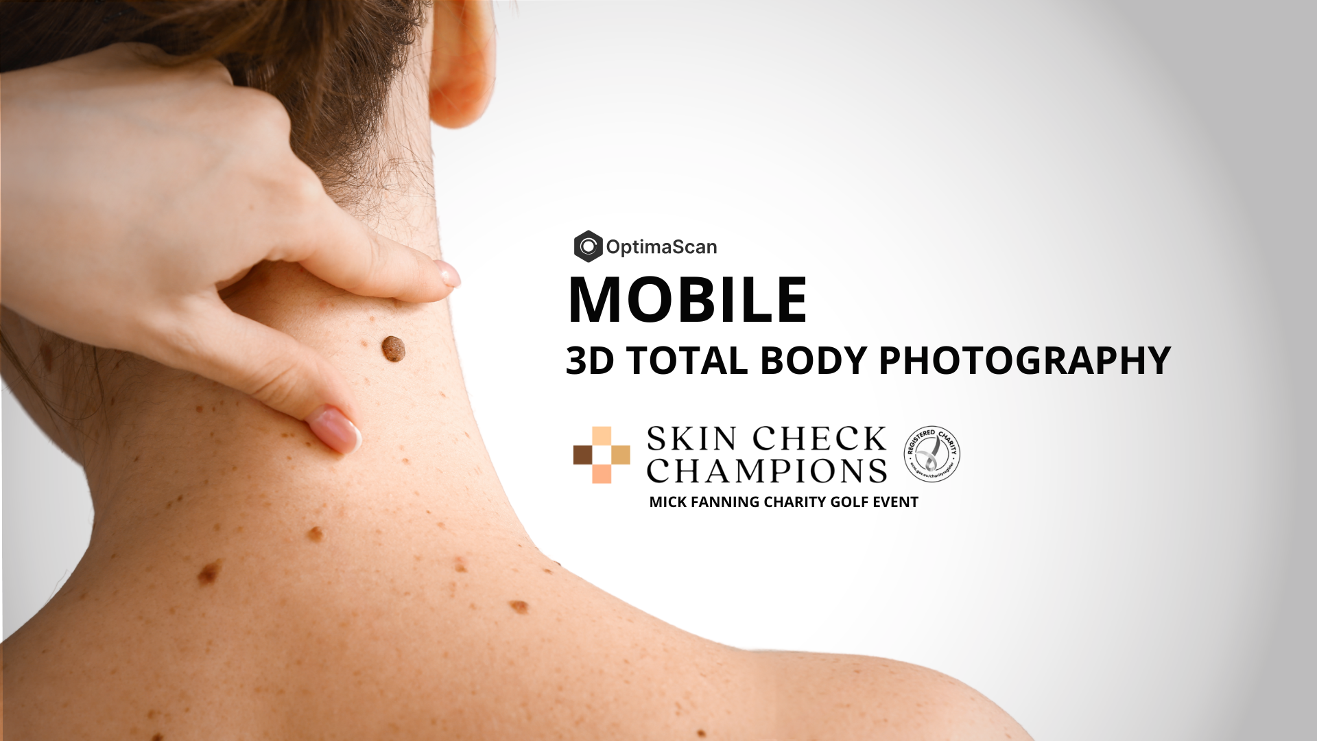 Can Mobile 3D Imaging Improve Skin Cancer Detection Access?
